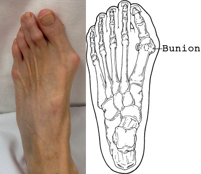 Katz Podiatry | Foot & Ankle Specialists